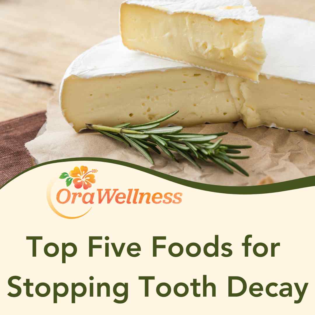 How to stop tooth decay - quick, easy steps to live a cavity free life